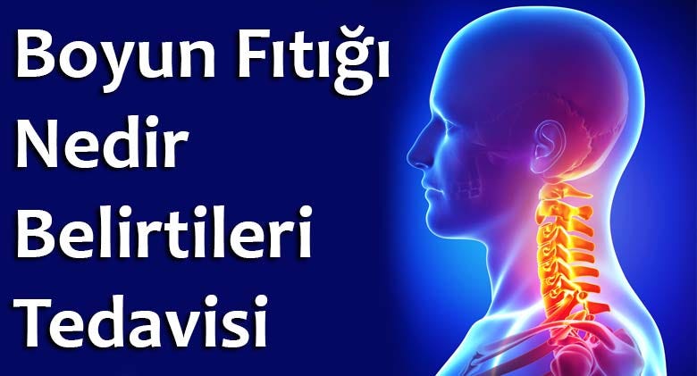 Boyun Fıtığı Nedir, Belirtileri, Tedavisi – İlaç ve Sağlık – Medium