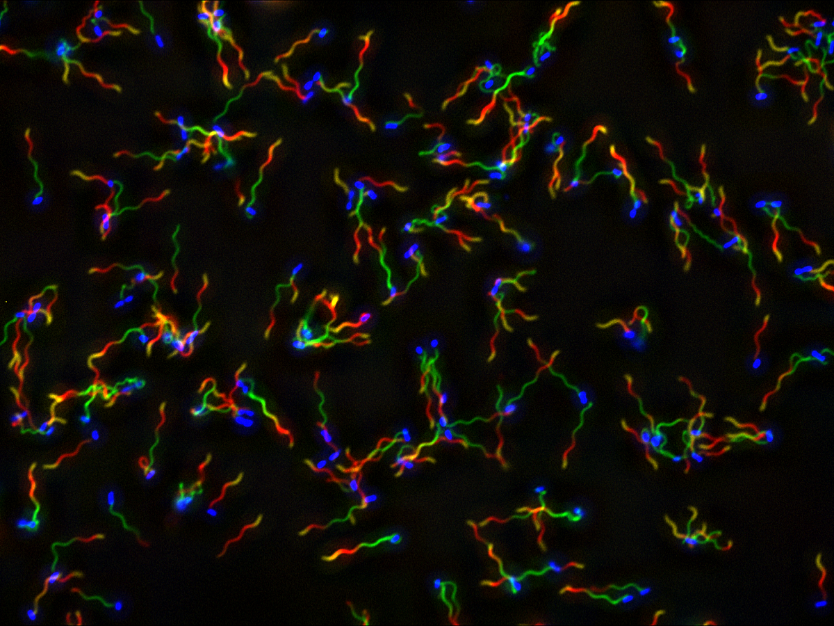 How do bacteria make flagella? – Life’s Building Blocks – Medium