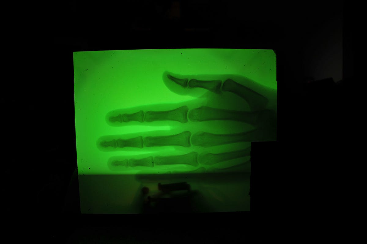 A DIY X-Ray Machine? Yes, a DIY X-Ray Machine – Hackster Blog