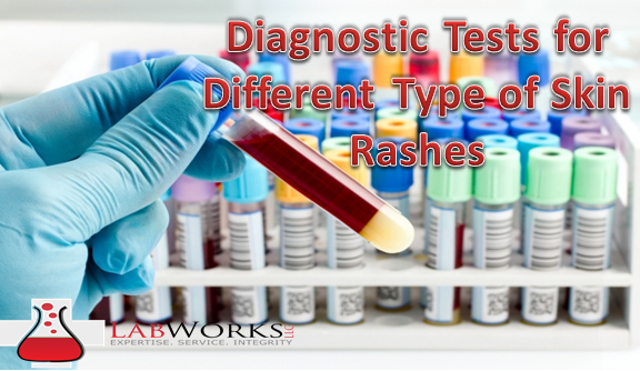 Diagnostic Tests for Different Type of Skin Rashes – Lab Work Service ...