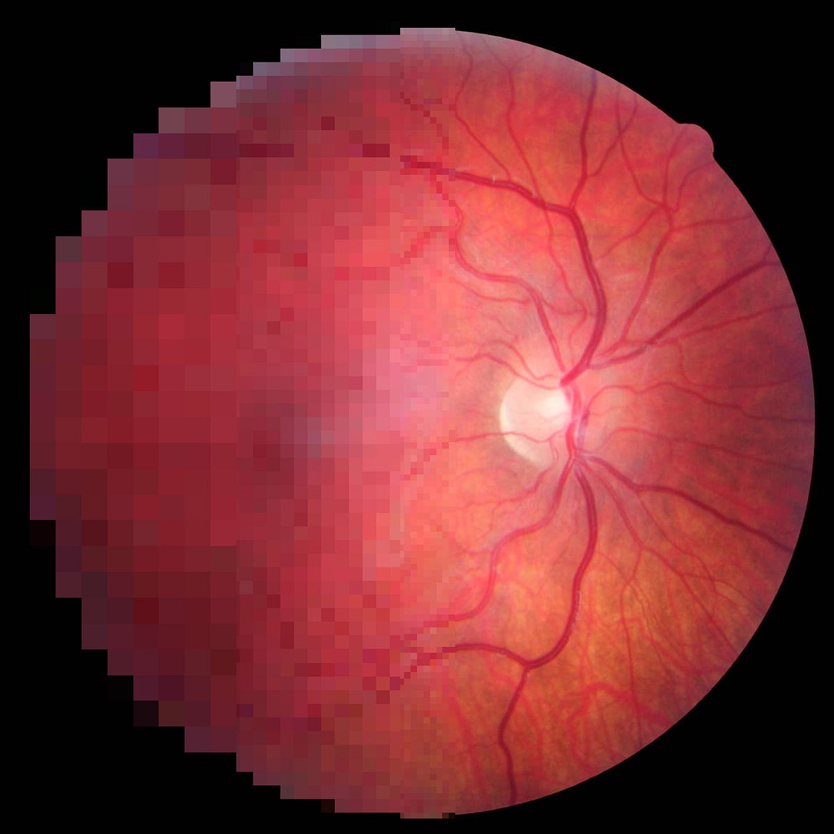 Working backwards to give clearer vision – Health and Disease – Medium