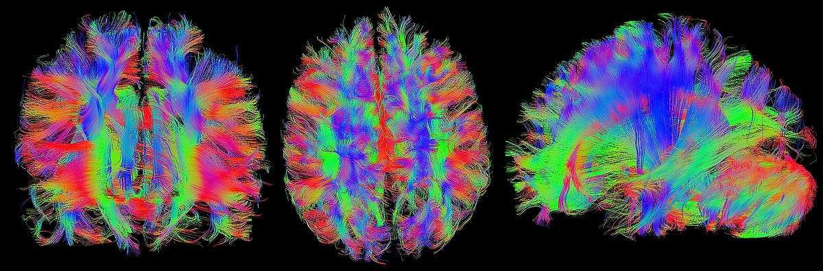 Brain regions that fire together, wire together – Brains and Behaviour ...