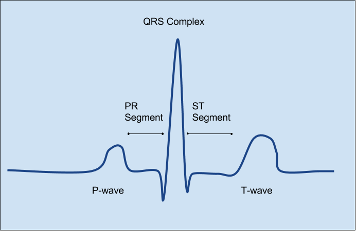Principal Components of Electrocardiograms – Andrew Tan – Medium