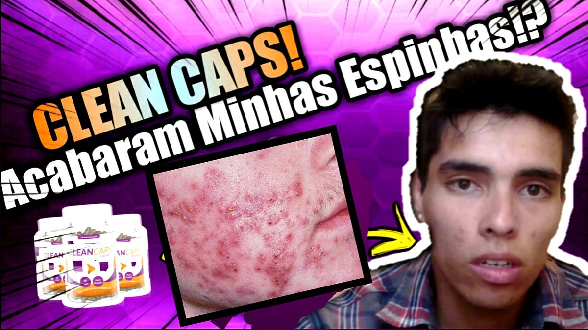 Clean caps REALMENTE Funciona? Clean caps VALE A PENA? [Clean Caps ...
