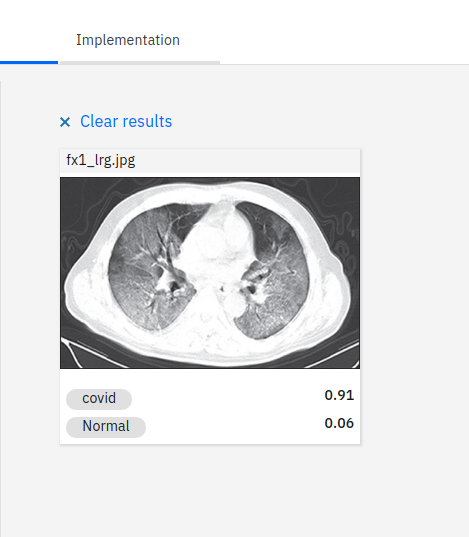 Building CNN Models To Detect COVID-19 From Medical Images. – Medium