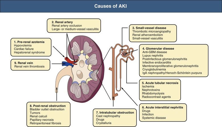 News: Google’s AI will predict acute kidney injury (AKI)