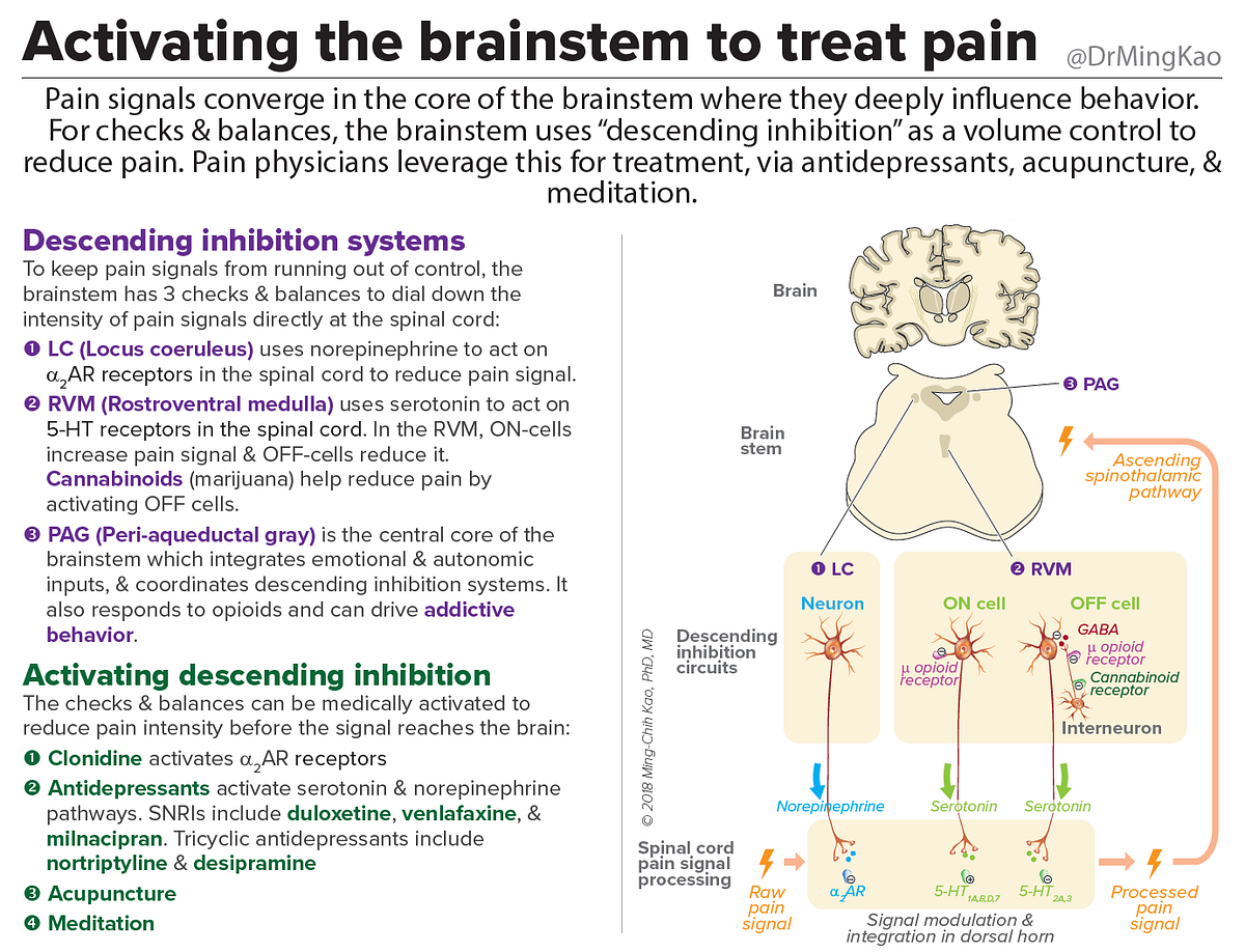 Activating the brainstem to treat pain – Within Normal Limits of Reason ...