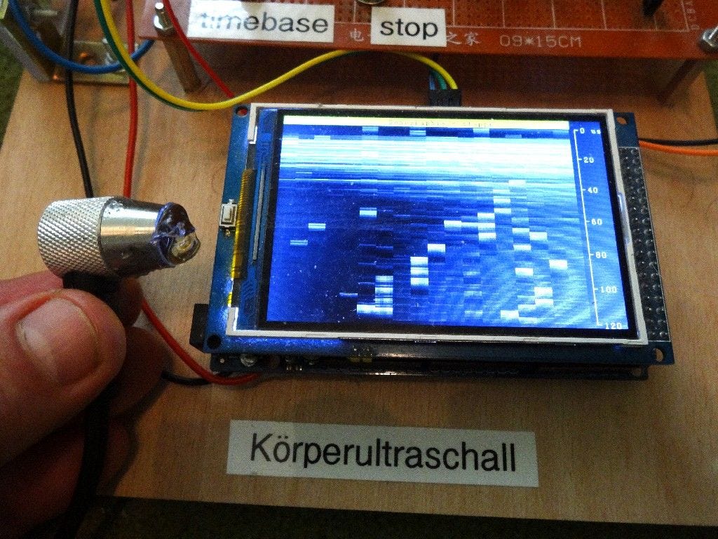 A Diy Ultrasound Built With An Arduino Hackster Blog