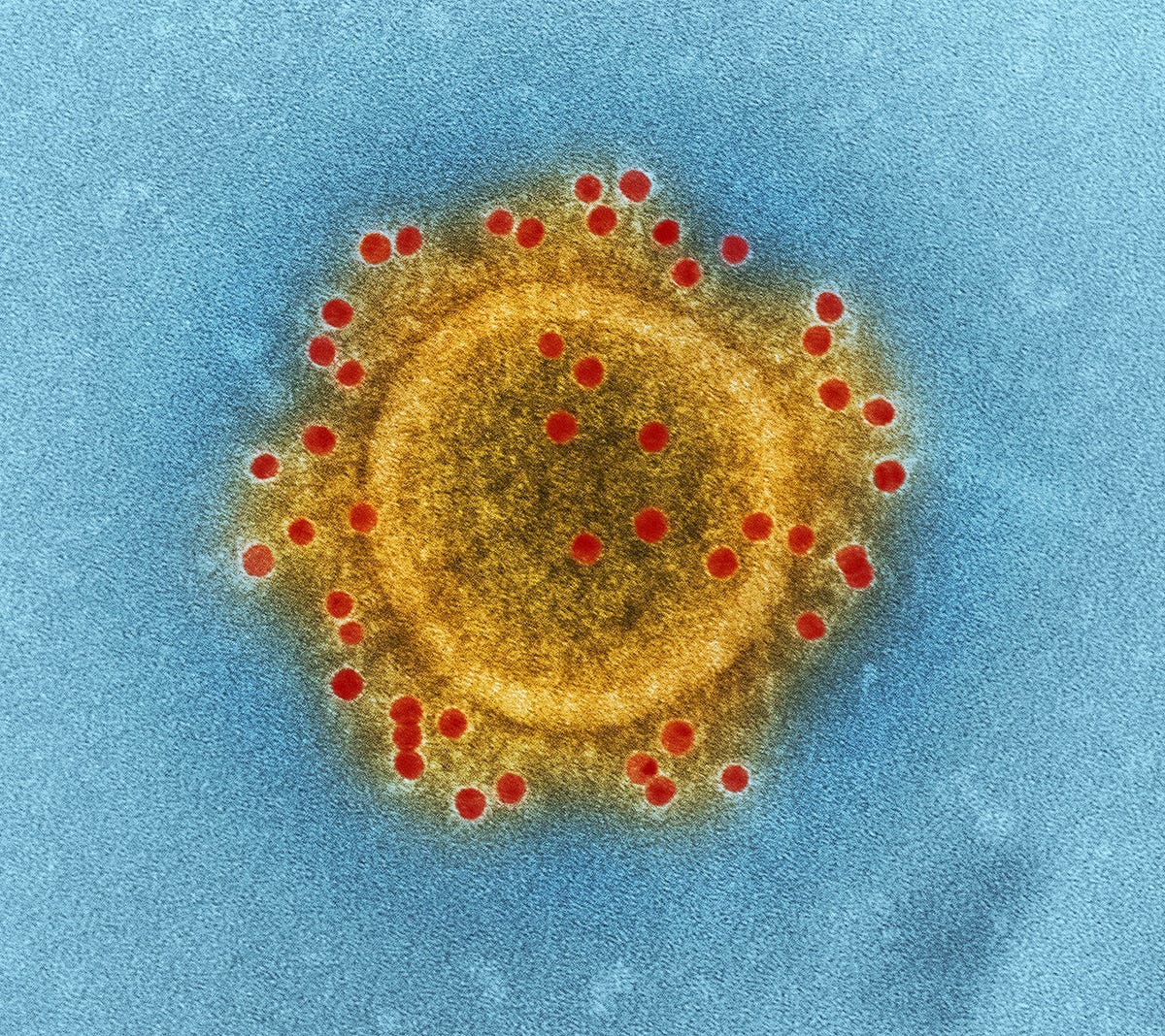 The People’s Coronavirus - Medium