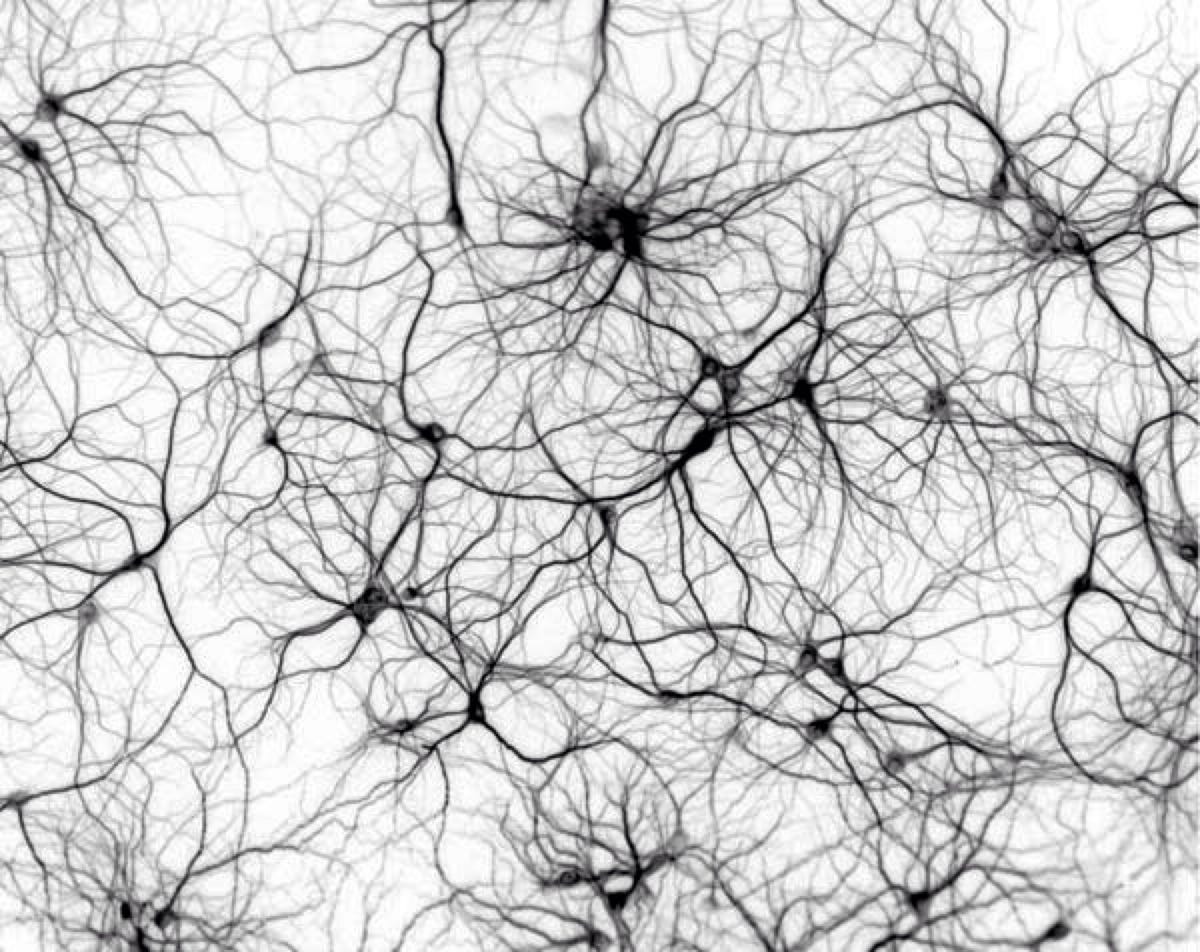 The dark neuron problem – The Spike – Medium