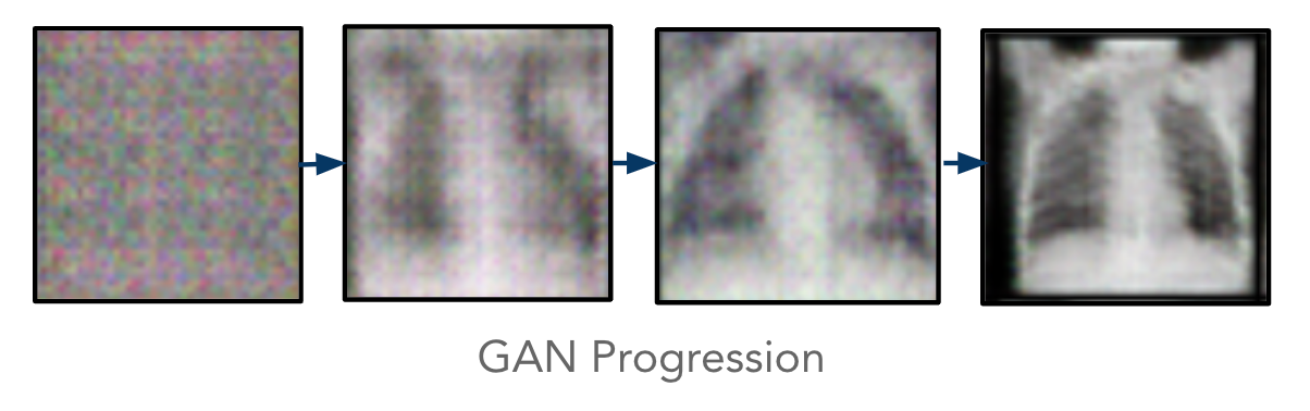In this post, we train a GAN to generate fake chest X-rays, looking at how small changes to ...