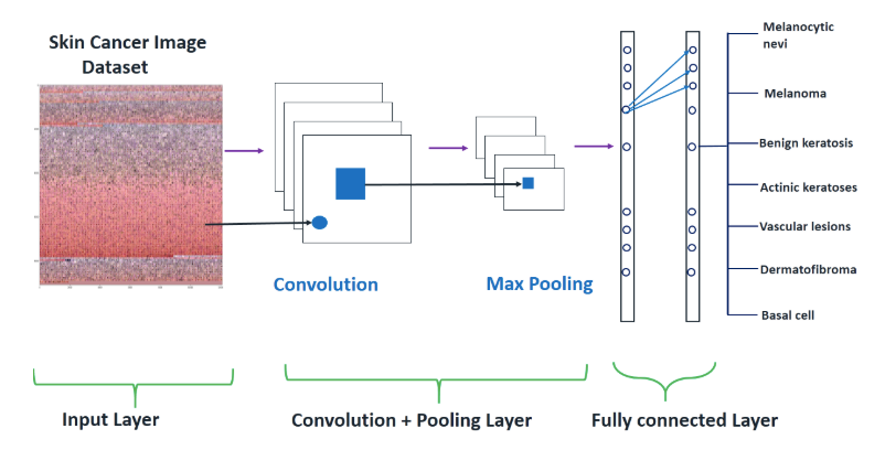 Detecting Skin Cancer Using Deep Learning Mishaal Lakhani Medium