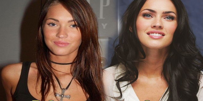 Megan Fox Plastic Surgery Timeline — Celebrity plastic surgery ...