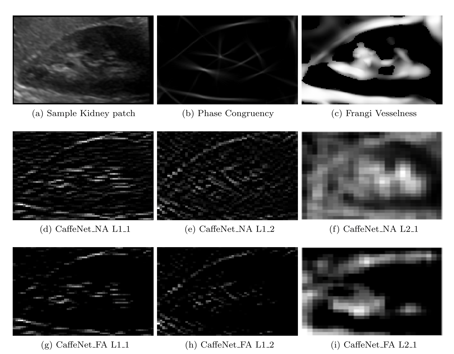 Understanding the Mechanisms of Deep Transfer Learning for Medical Images