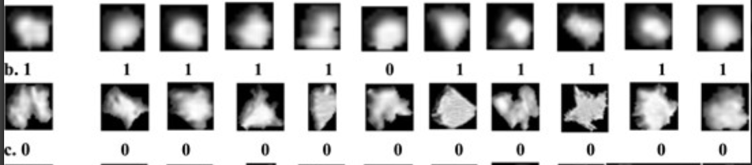It’s Chest Day: Uses of Deep Learning In Chest Abnormality Detection