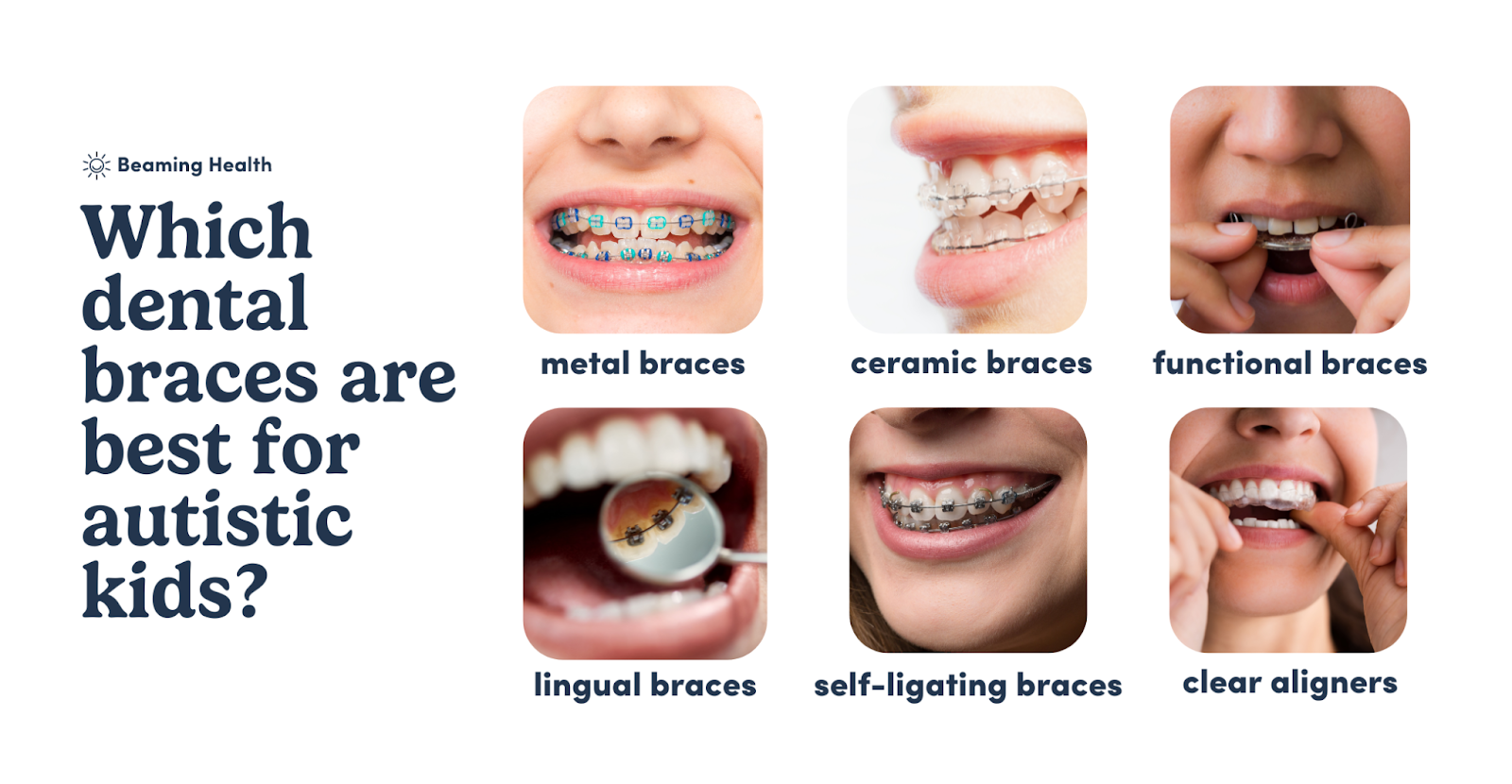 Orthodontists for autism: A complete guide | Beaming Health