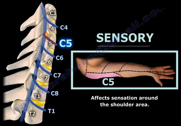 Neck Pain, Cervical Disc Herniation, & Cervical Radiculopathy