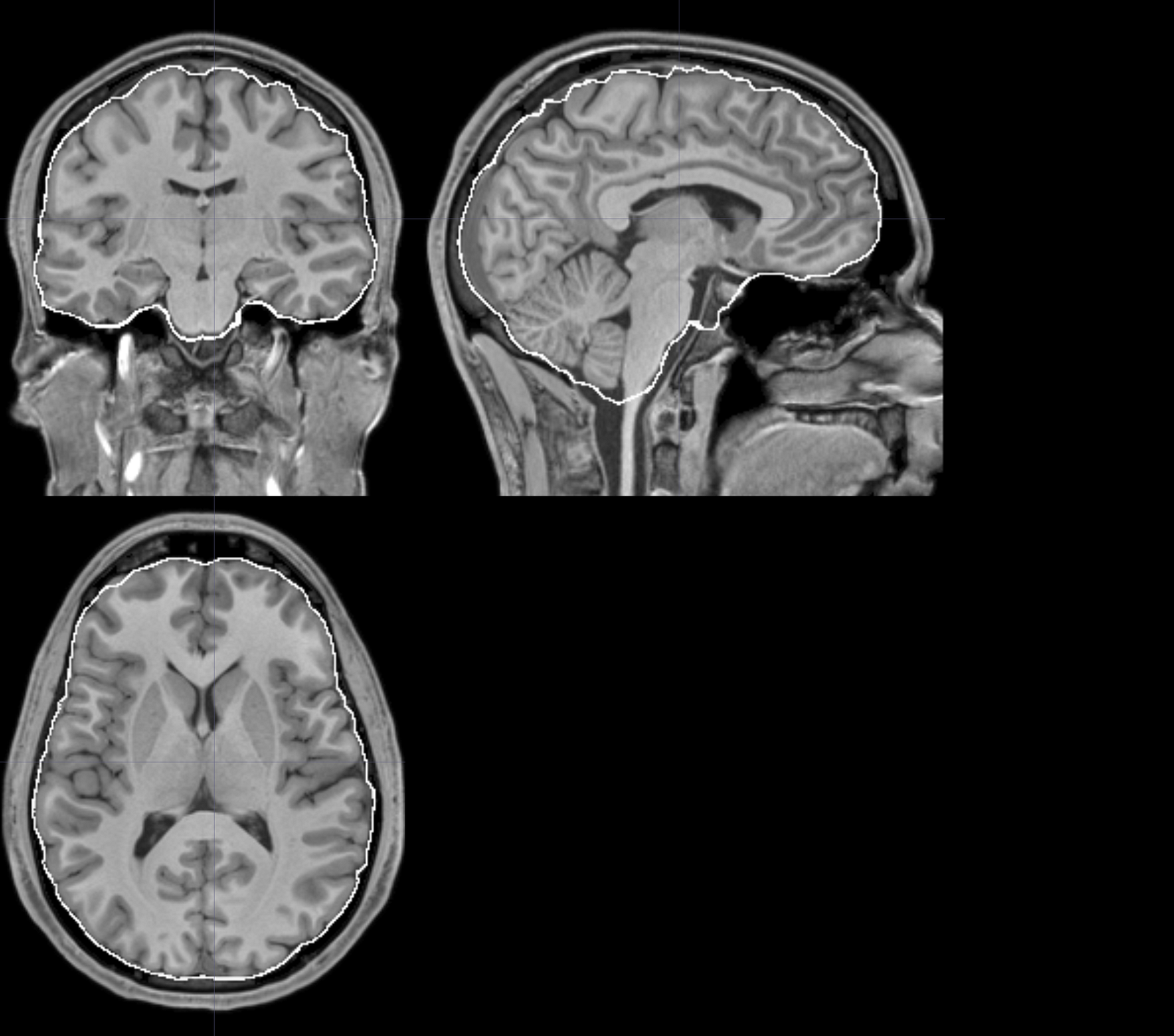 How to use FSL brain extraction – Selective Sapience – Medium
