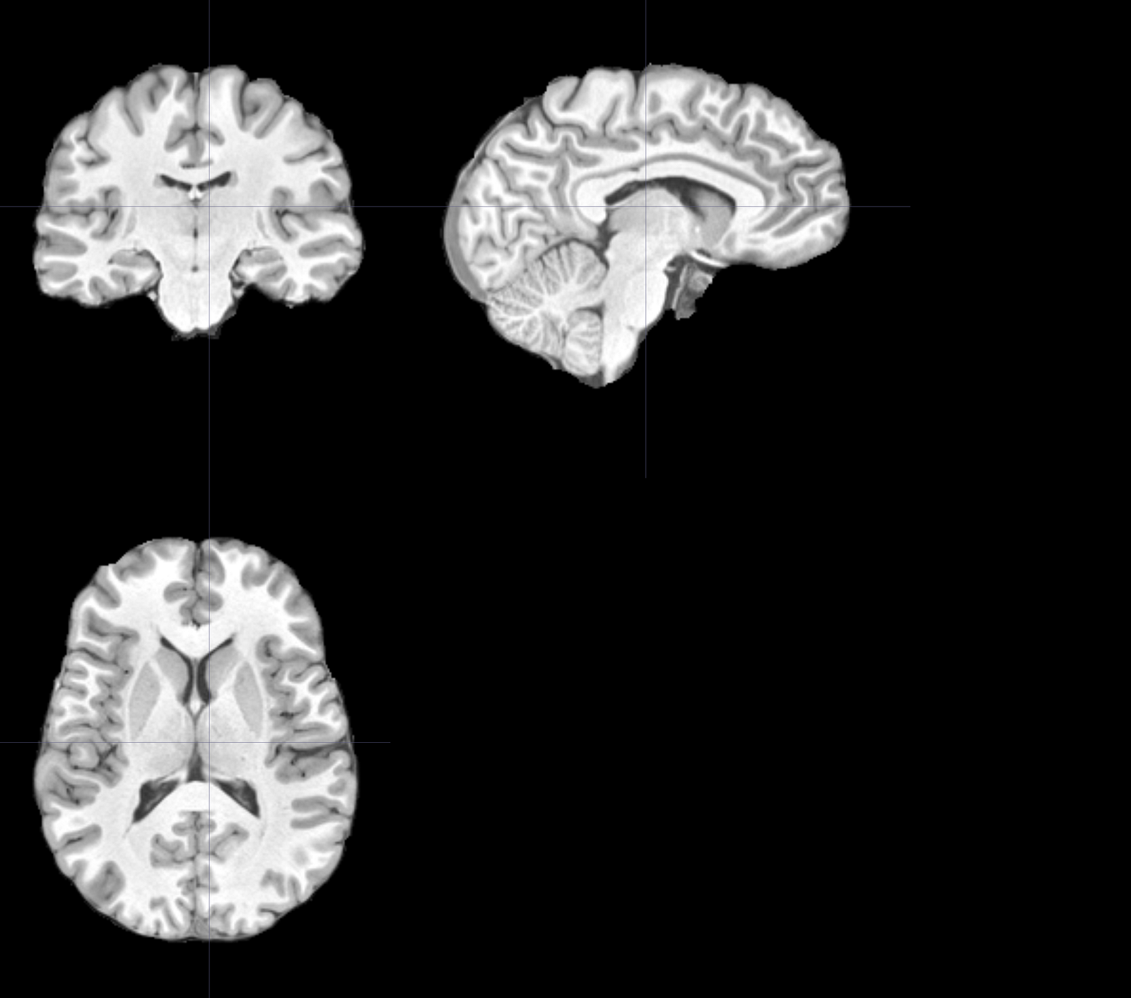 How to use FSL brain extraction – Selective Sapience – Medium