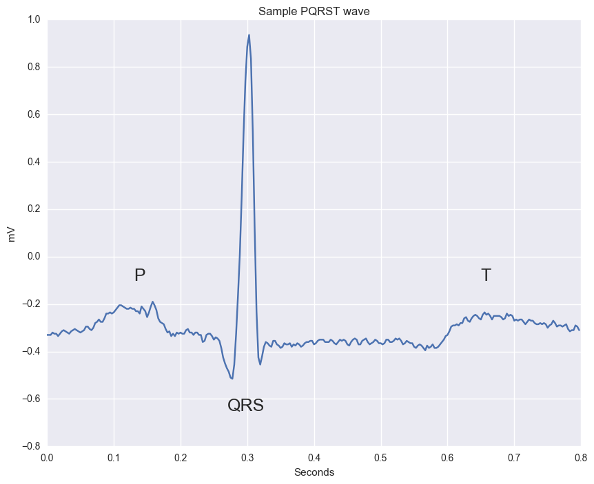 Principal Components of Electrocardiograms – Andrew Tan – Medium