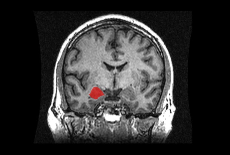 The United States of Amygdala? – The Omnibus – Medium