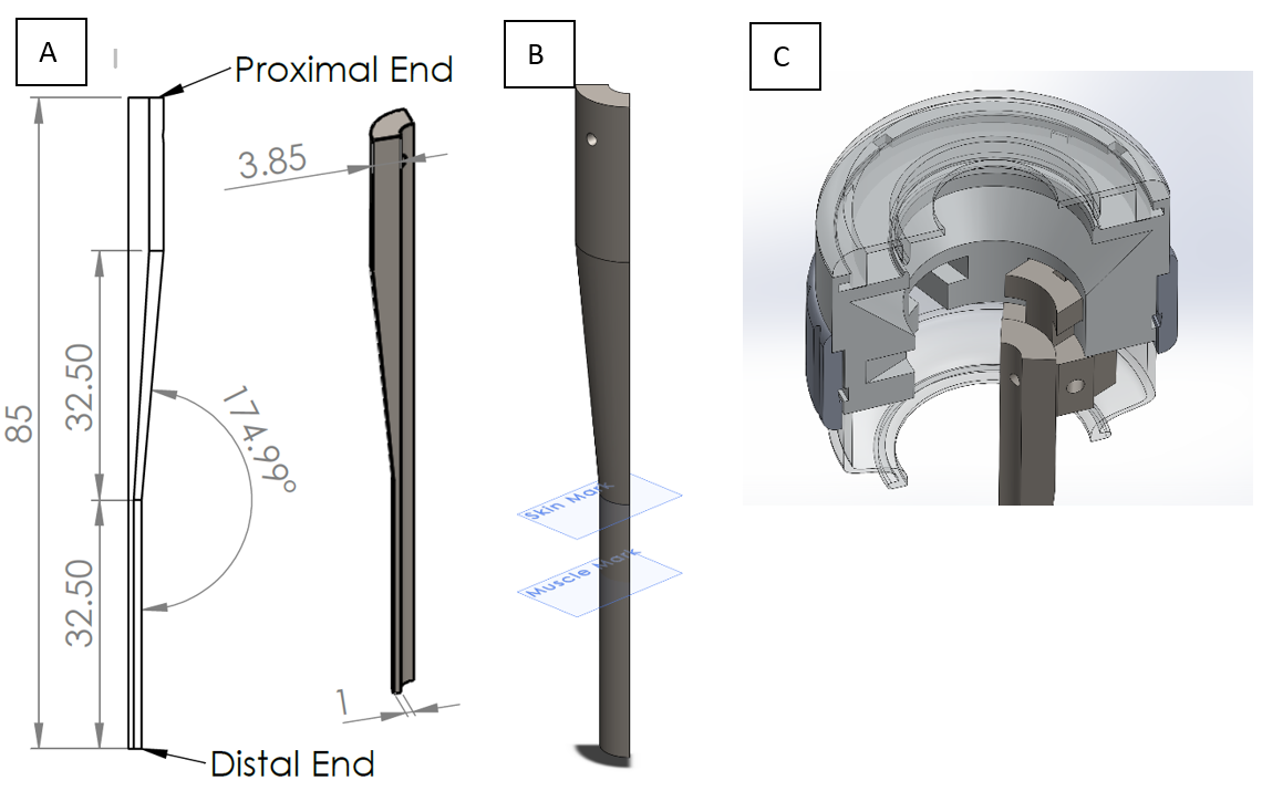 Design of an Adjustable Trocar – Shaurya Gupta – Medium