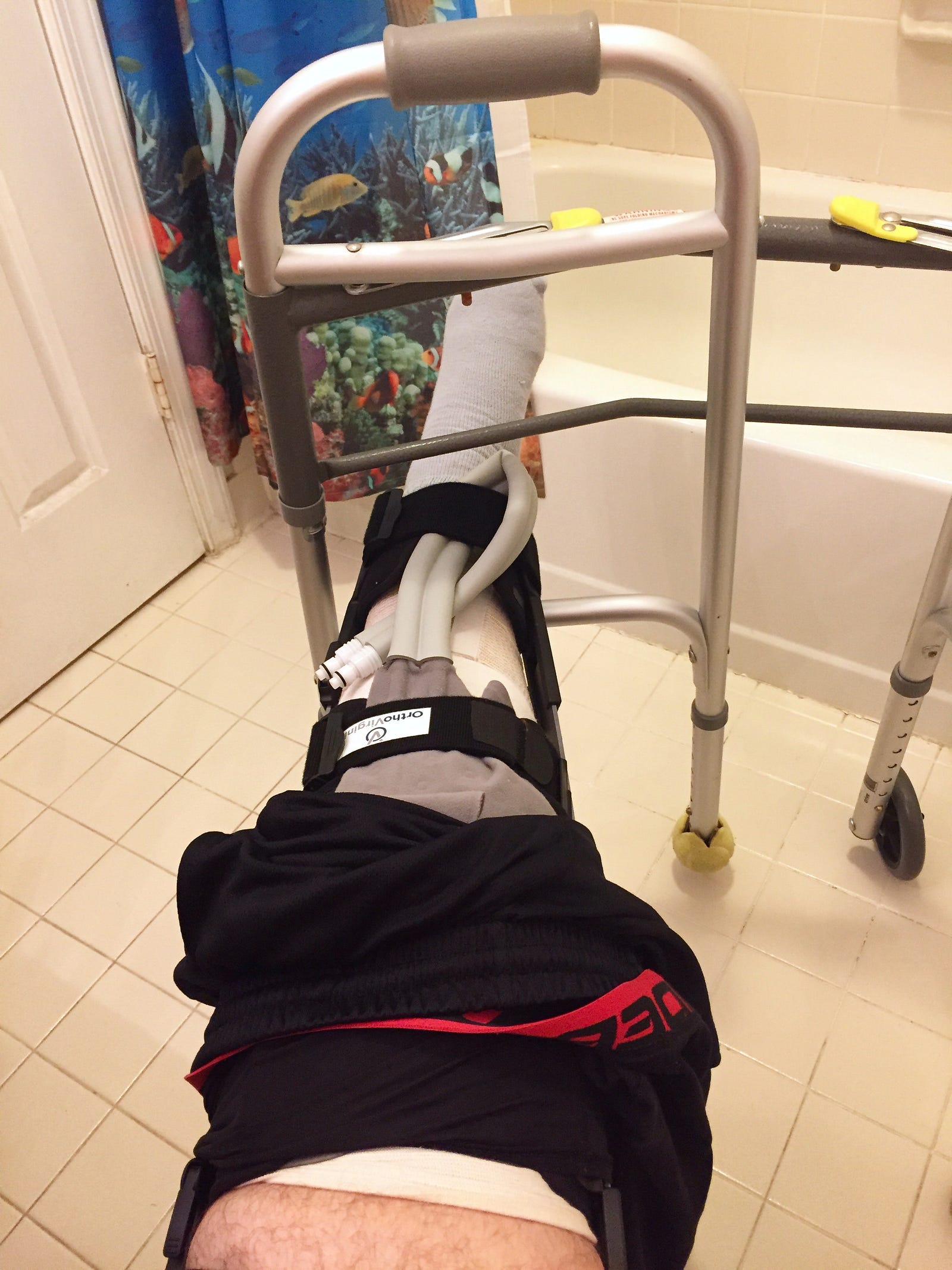 Recovering from MPFL Reconstruction – David’s MPFL Story – Medium