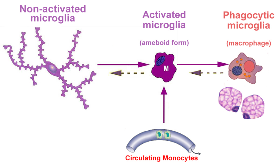 The Tale of Inflammation, Microglia, and Alzheimer’s