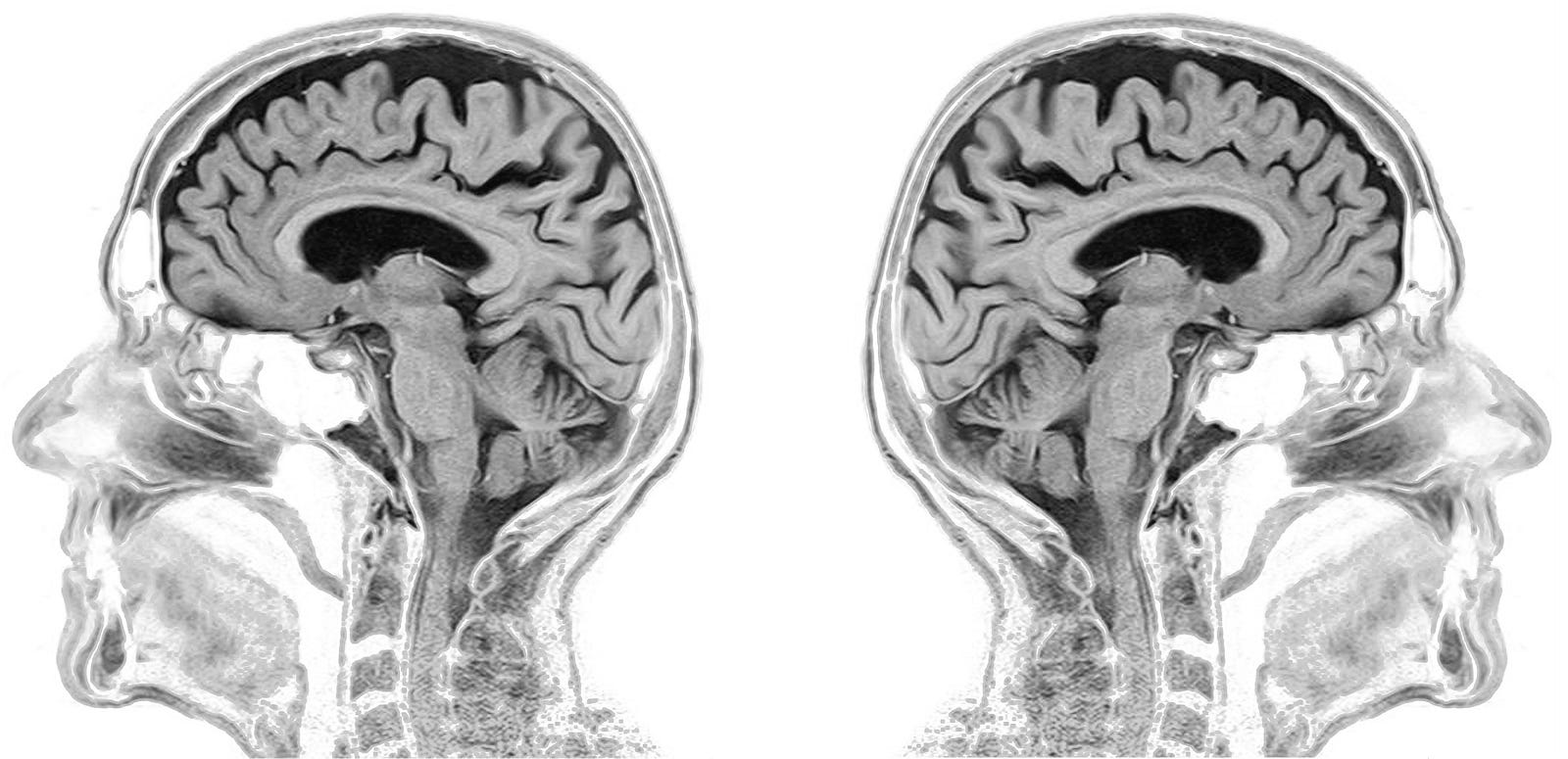 Implementing the general linear model (GLM) in Python for fMRI data ...