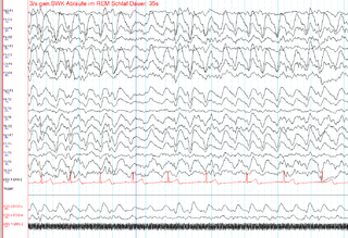 Improve performance of models deployed with Triton