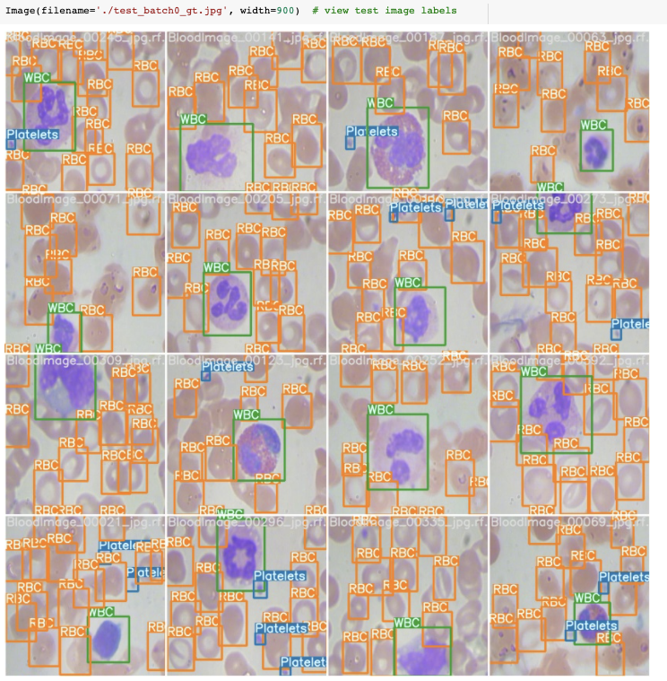 How To Train A Custom Object Detection Model With Yolo V5 Laptrinhx