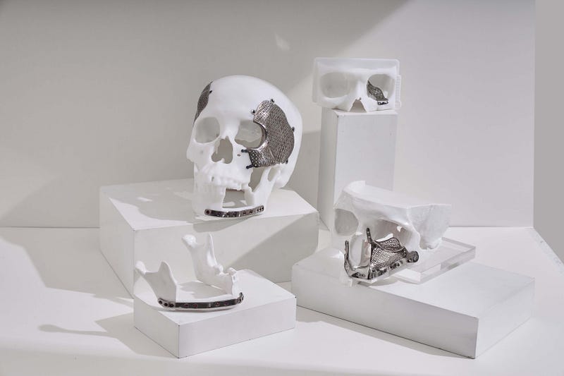 Meticuly: Revolutionizing the Future of Medical Implants with AI and 3D ...