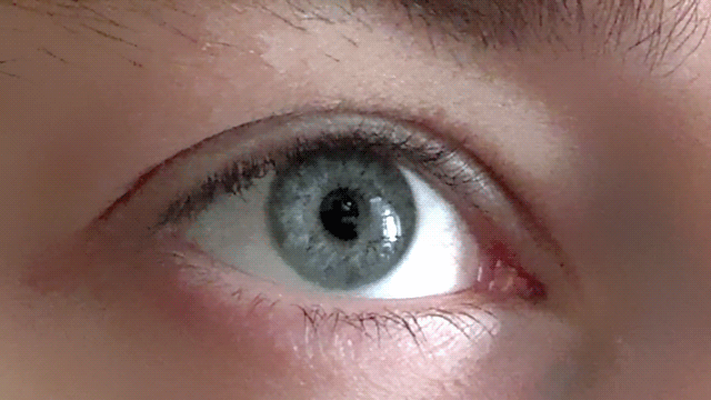 Pupils Dilated Gif